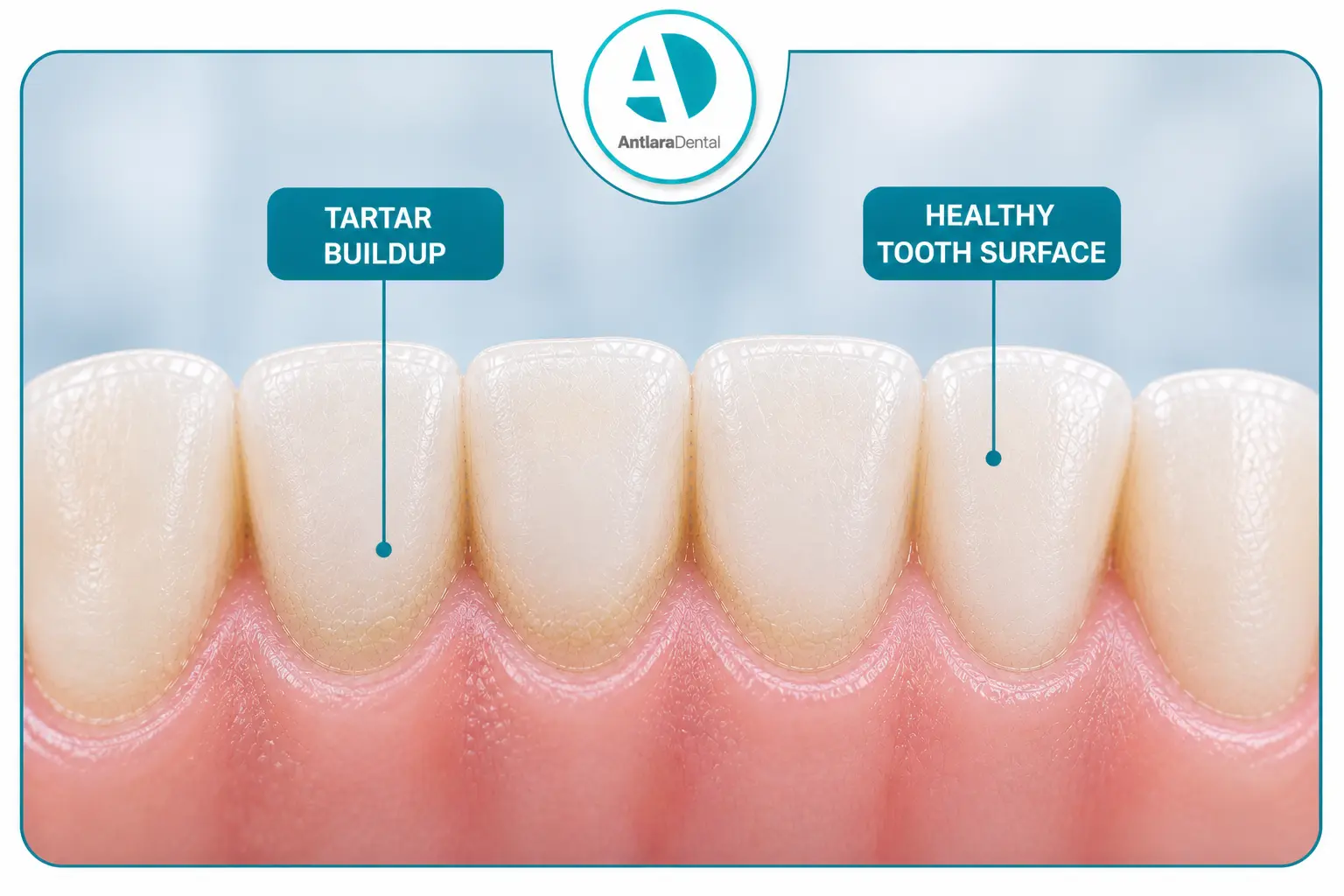 Why Are My Gums Bleeding? Causes, Fixes & When to Worry